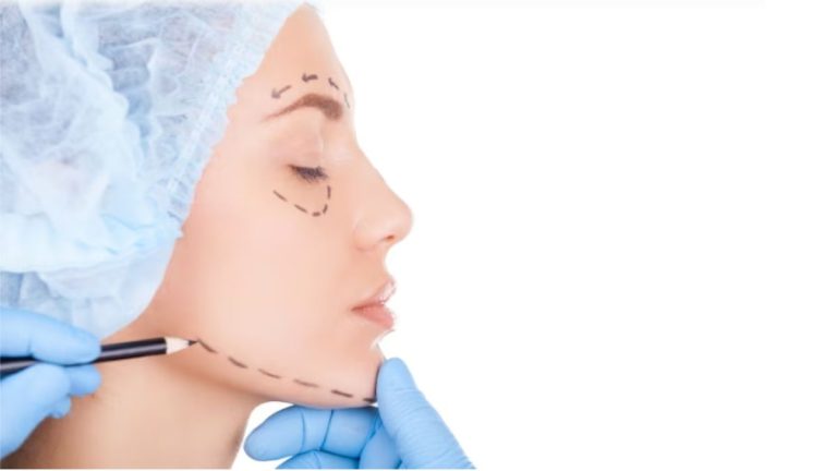 The Functional Benefits of Reconstructive Plastic Surgery - Tumgazeteler